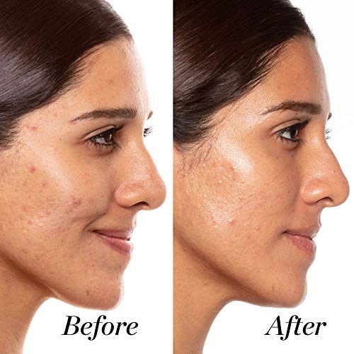 Sunday Riley A+ High-Dose Anti Aging Retinol Serum