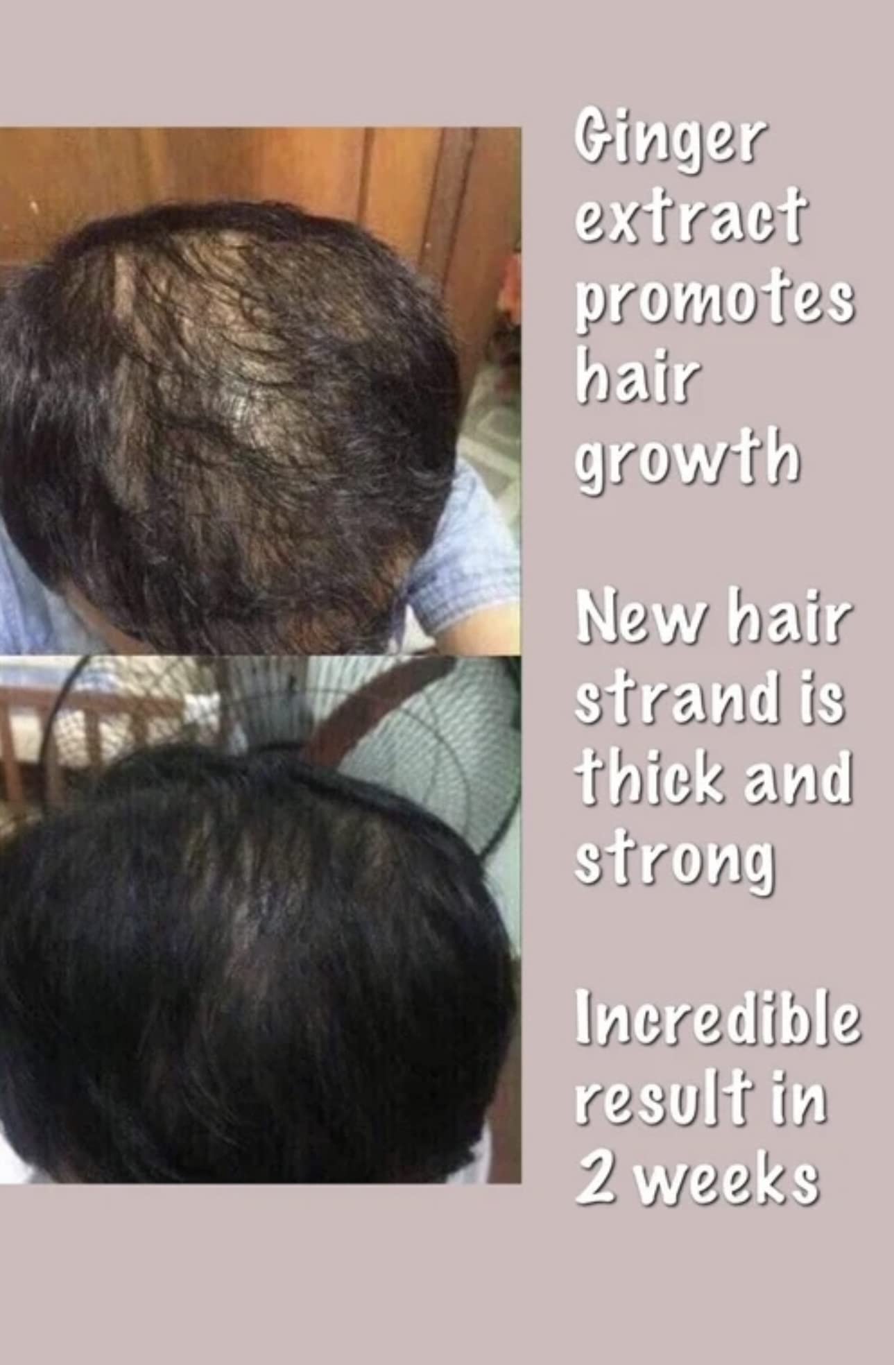 WEILAIYA White Ginger Prevent Hair Loss Shampoo 14g and Conditioner 14g Mini sample/travel/test try set for Normal/Oily Hair & Scalp