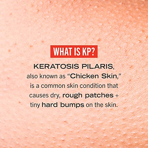 First Aid Beauty KP Bump Eraser Body Scrub Exfoliant for Keratosis Pilaris with 10% AHA 2 oz.