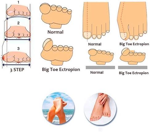 baolaili 1 Pair White Bunion Cushion and Protector Silicone Big Toe and Relieve Bunion Pain Bunion Pads Gel Bunion Corrector Guards Pad Cushion Toe Protector Straightener Toe Separators Realign