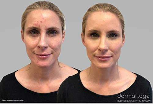 Waterproof Concealer Cream, Full Coverage Waterproof Makeup, Color Match Promise by Dermaflage, 6g/.2oz (Tan)