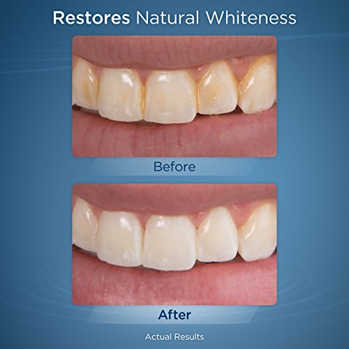 Waterpik Whitening Water Flosser, White (WF 05) Electric Oral Irrigator Flosser Whitens Teeth Gently