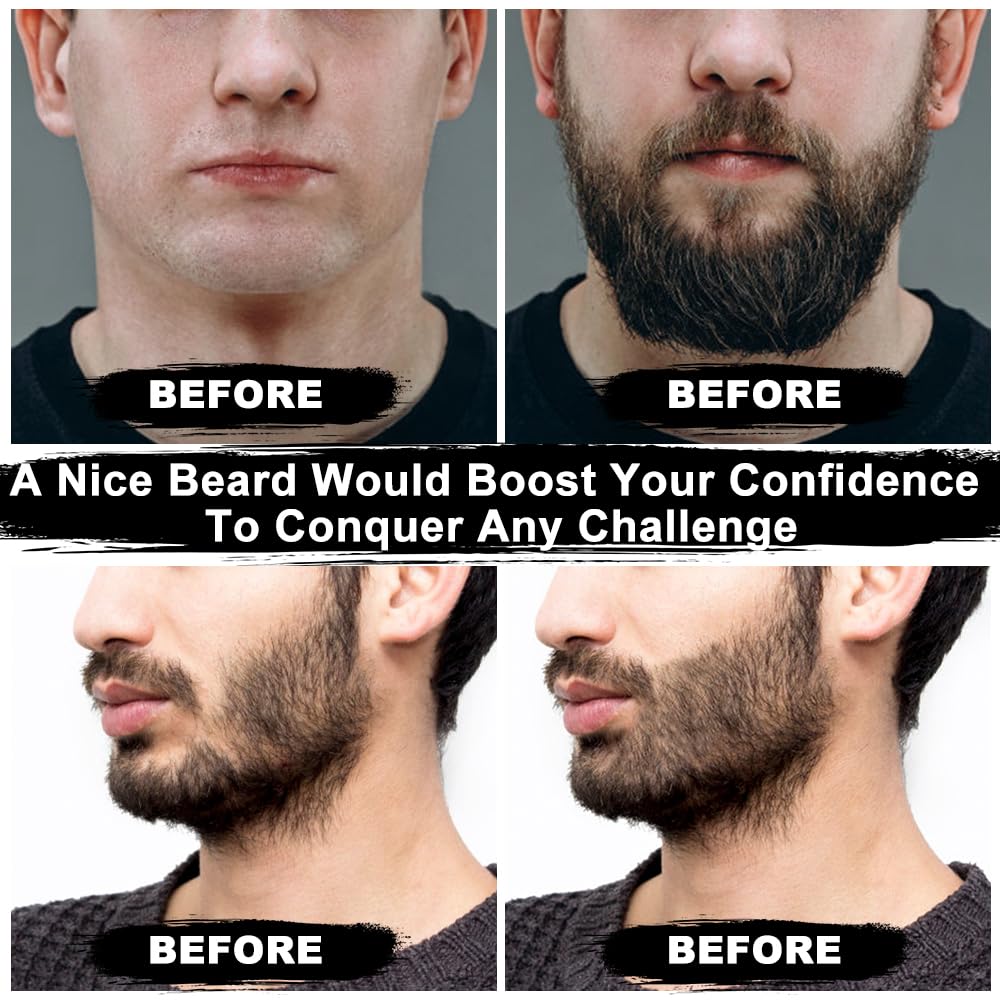 Beard Growth Kit,Fathers Gifts for Men Dad Husband W/Beard Derma Roller,2 Pack Beard Oil,Beard Serum,Wash,Balm,Brush,Comb,Scissor for Beard Grooming Care,Christmas Stocking Stuffers Nail Art Fimo