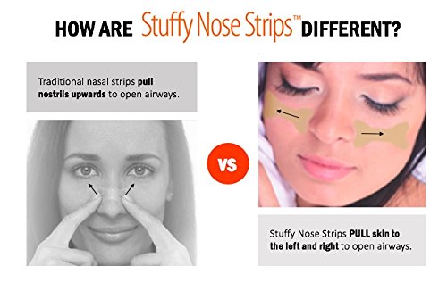 Nasal Strips - Stuffy Nose Strips - GO ON CHEEKS NOT OVER NOSES! INSTANT RELIEF For Allergies, Colds, Flu, Sinus Issues and Snoring. PULLs Open Airways by Over 61% vs 30% for Nose Strips! 30 Ct