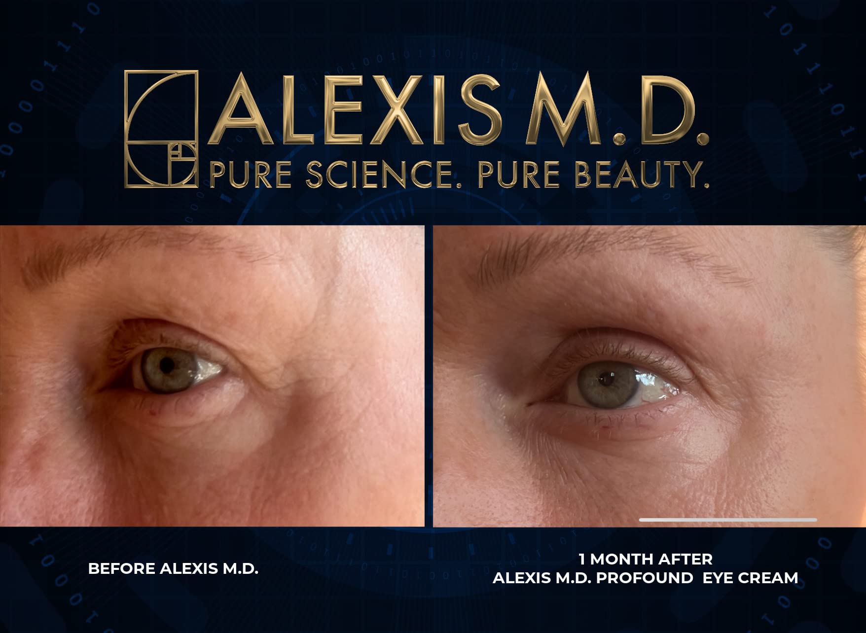 ALEXIS M.D. Profound Eye Cream | 30ml | 1oz