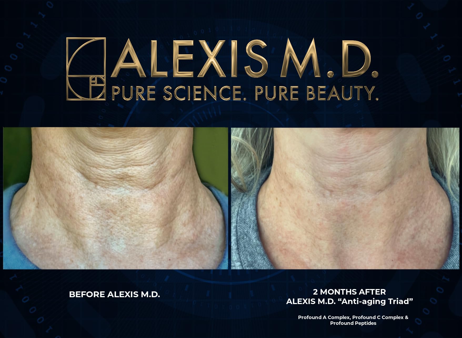 ALEXIS M.D. Profound Eye Cream | 30ml | 1oz