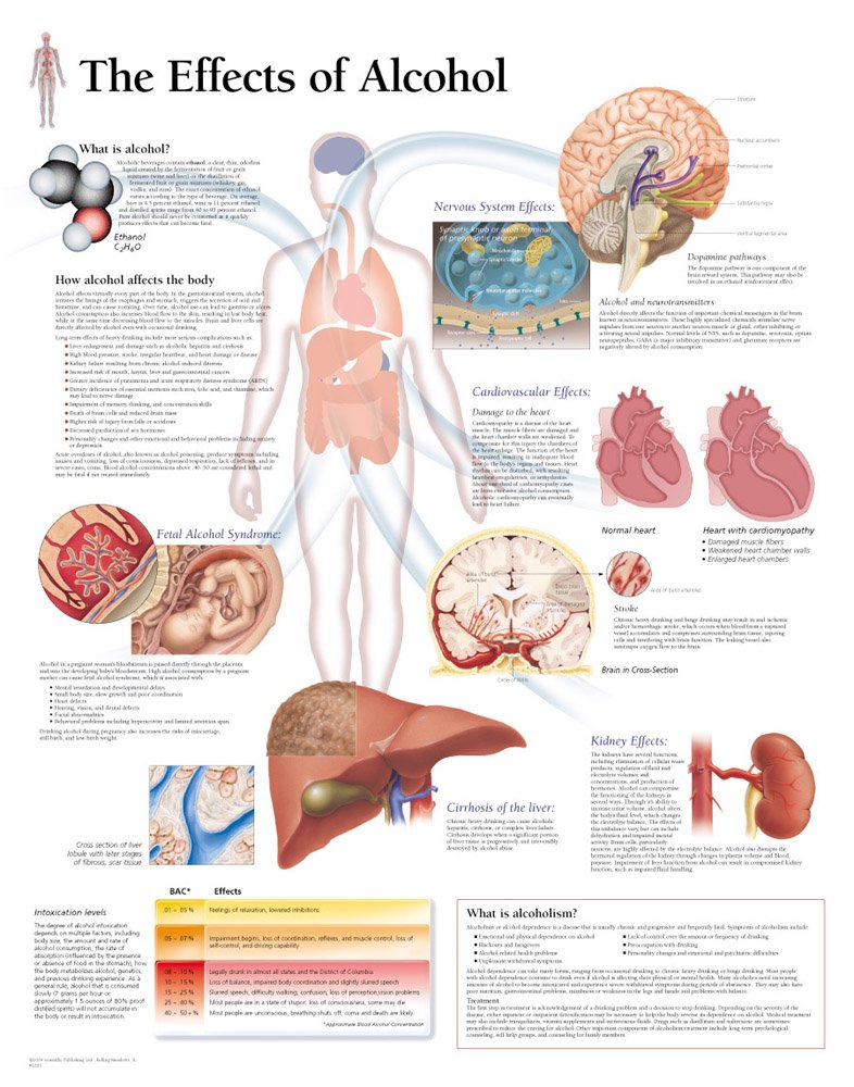 The Effects of Alcohol chart: Laminated Wall Chart
