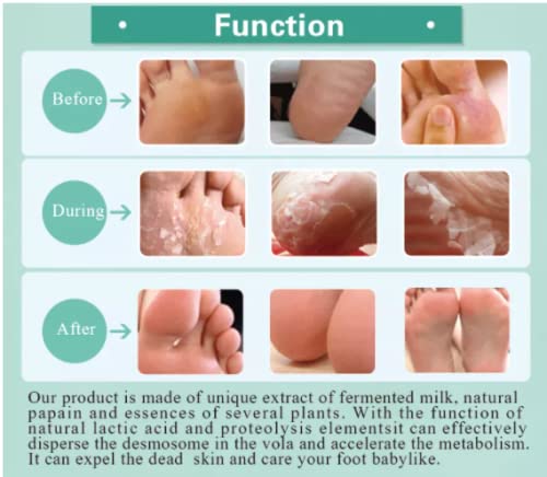 Peach Foot Peel Mask - Repair Cracked Heels, Remove Dead Skin. Makes Your Feet soft And Beautiful