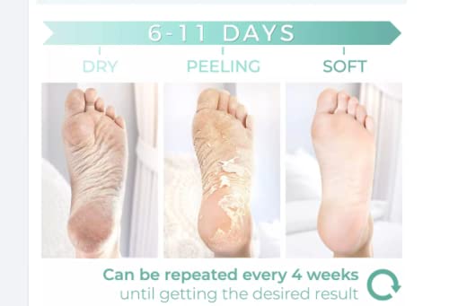 Peach Foot Peel Mask - Repair Cracked Heels, Remove Dead Skin. Makes Your Feet soft And Beautiful