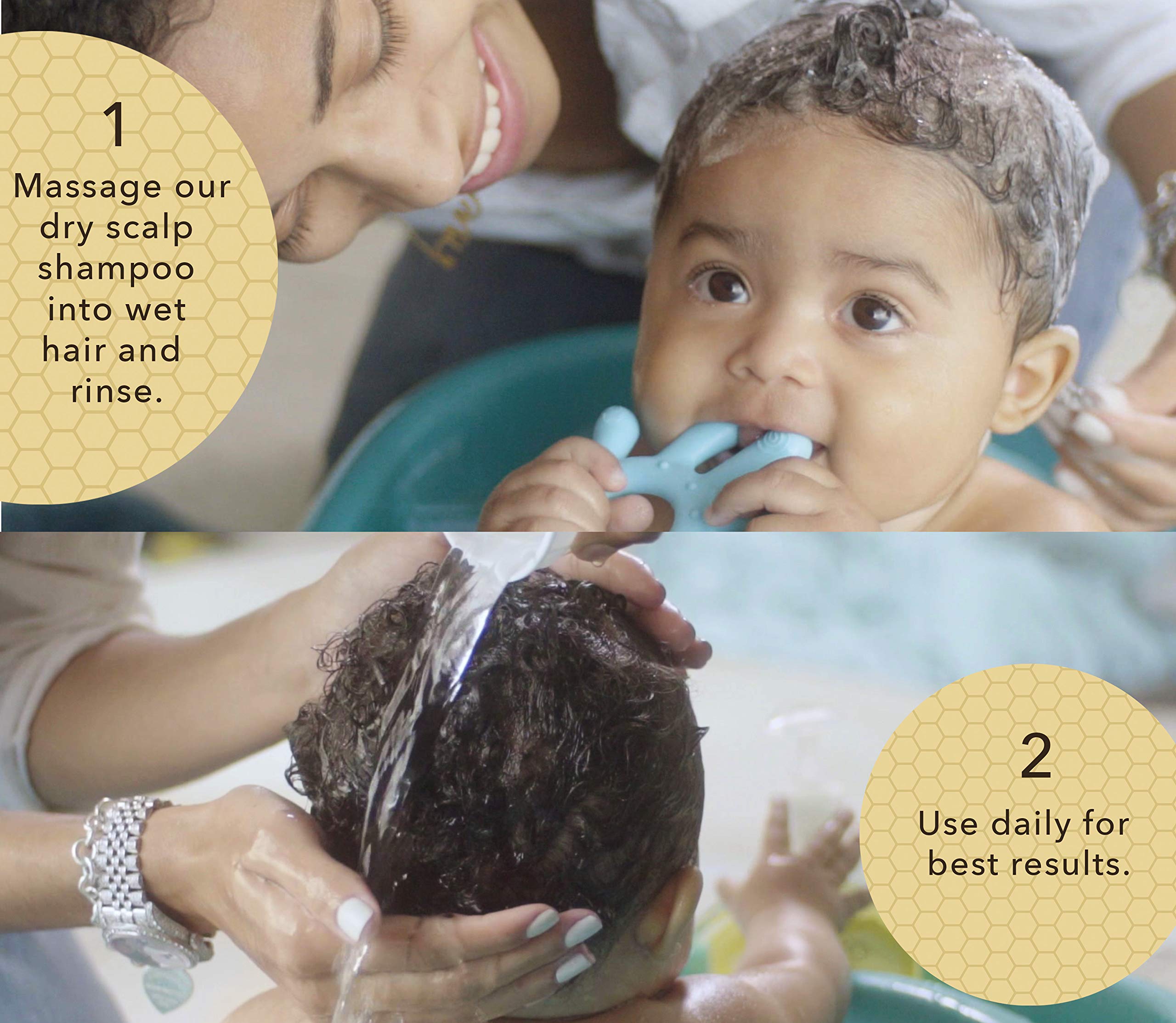 BELLA B Cradle Cap Shampoo & Cradle Cap Scalp Treatment And Conditioner - Baby Shampoo And Conditioner - Cradle Cap Shampoo For Babies - Kid Shampoo - Dry Scalp Shampoo And Conditioner For Dry Scalp