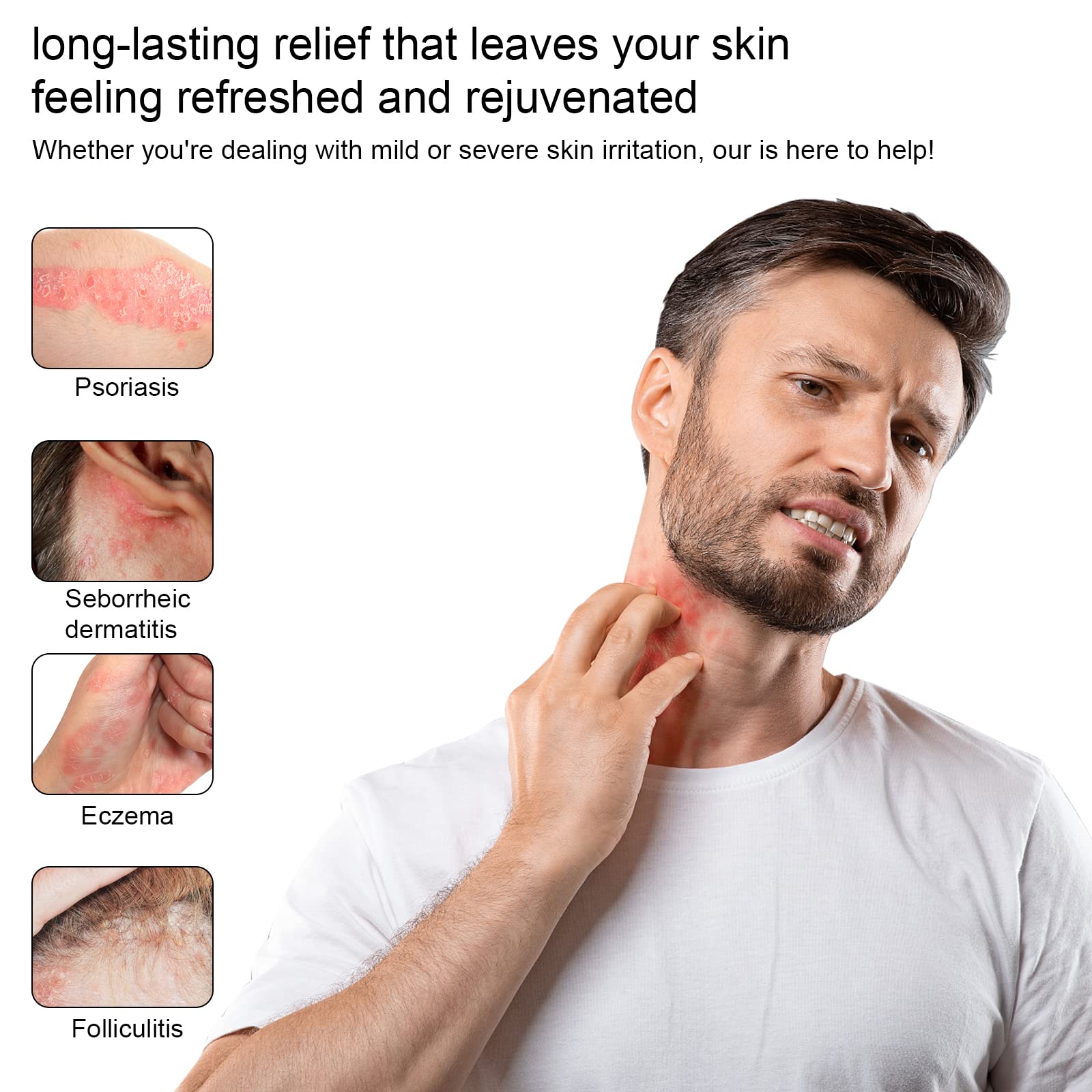 Honey Tea Tree Drawing Salve Ointment Cream, Ingrown Hair, Boils, Splinters, Insect Bites, Poison Ivy, Cyst Removal Patch, Chigger, Carbuncle, Pilonidal, Bug, Mosquito, Spider, Bee Sting, Itch Relief