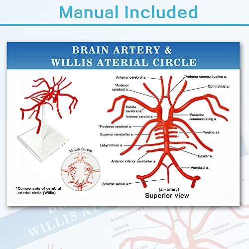 Evotech Brain Artery Model, Life Size Intracranial Artery Model, Shows Internal Carotid Artery, Willis Circle and Basillary Artery & Their Branches. On a Plexiglass Base