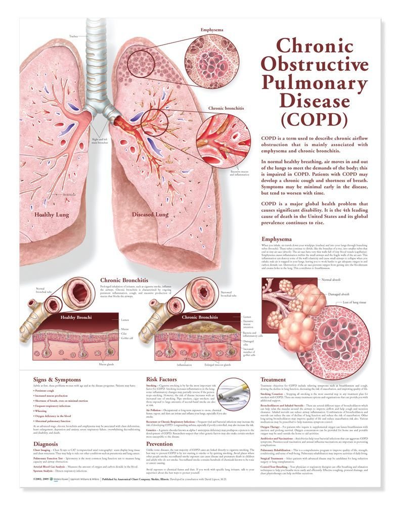 Chronic Obstructive Pulmonary Disease Anatomical Chart