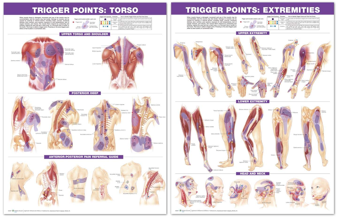 Trigger Point Chart Set: Torso & Extremities Lam