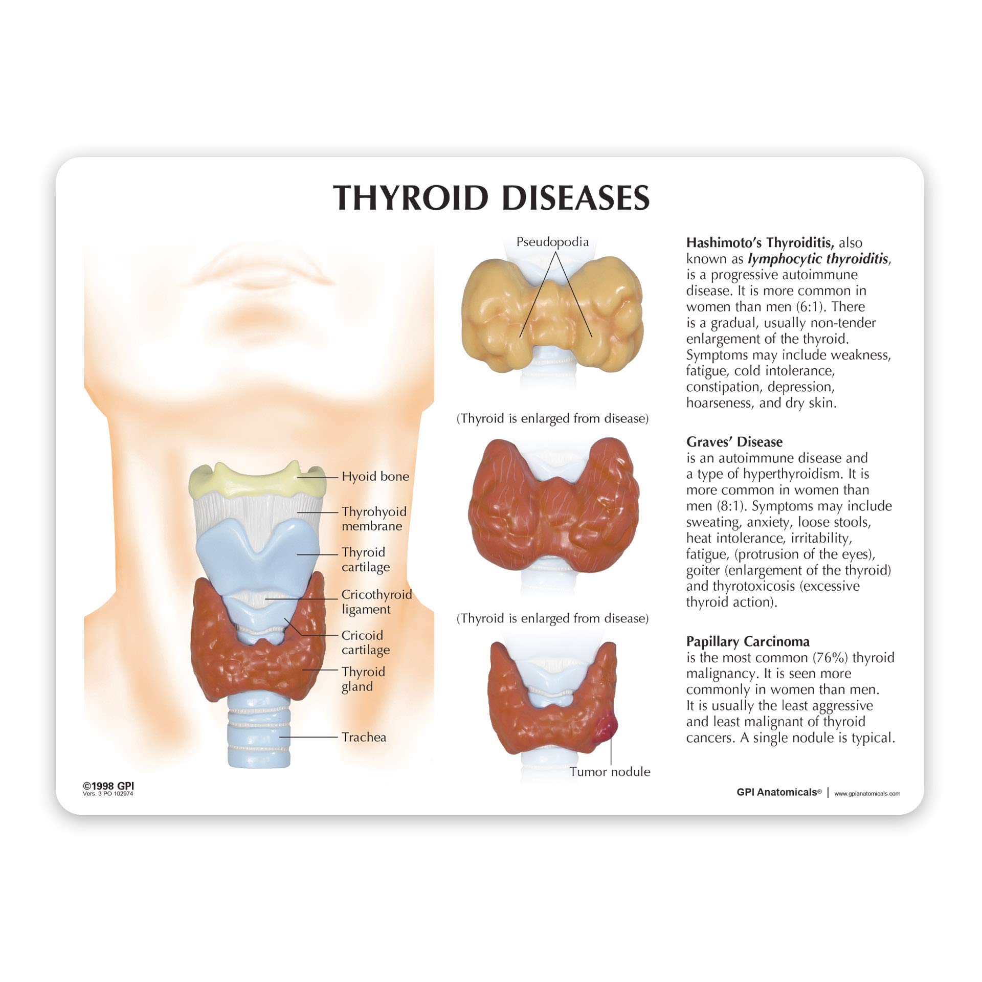 Thyroid Model Set | Human Body Anatomy Replica of Thyroid w/Diseases for Doctors Office Educational Tool | GPI Anatomicals