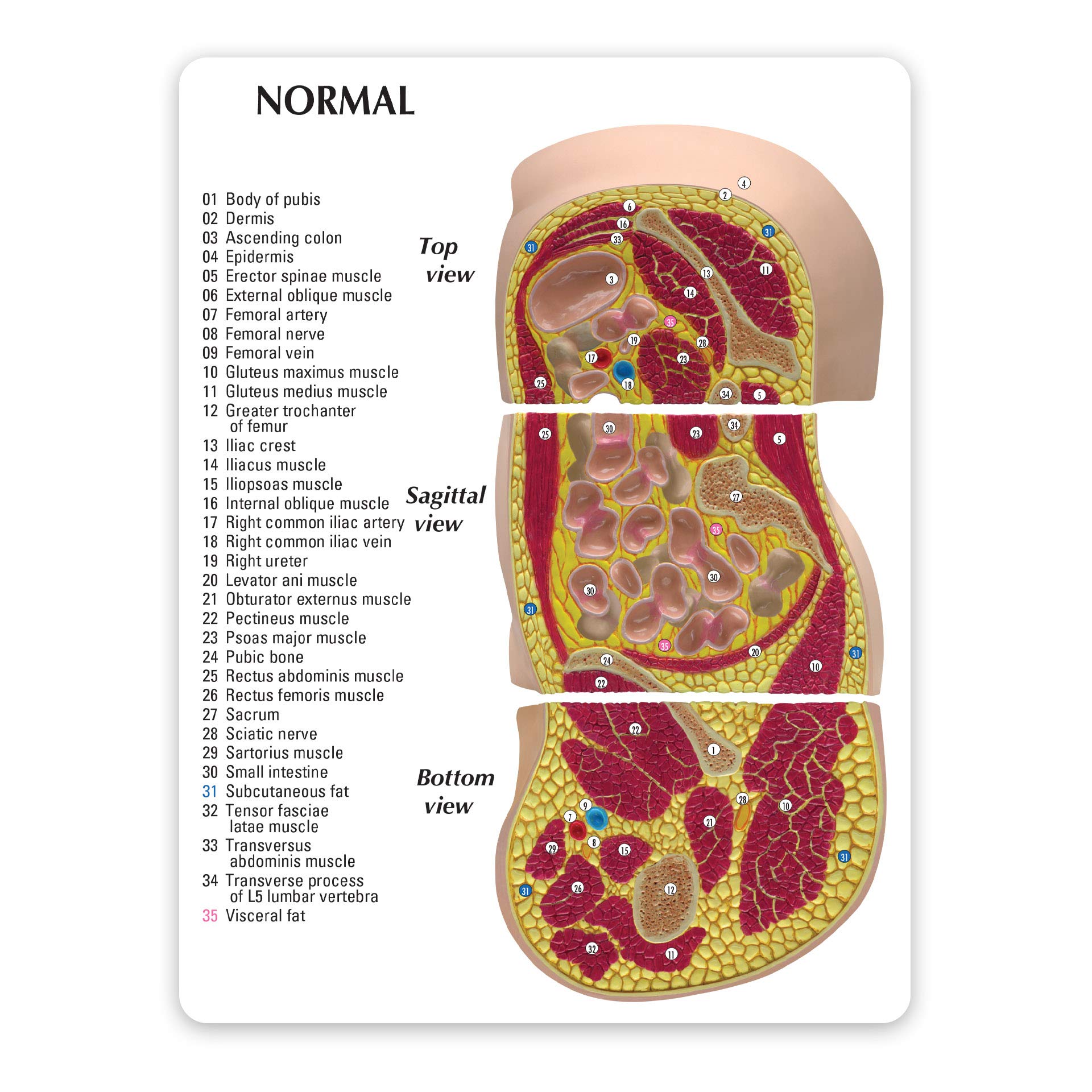 Obesity Model | Human Body Anatomy Replica of Overweight Body Types for Doctors Office Educational Tool | GPI Anatomicals