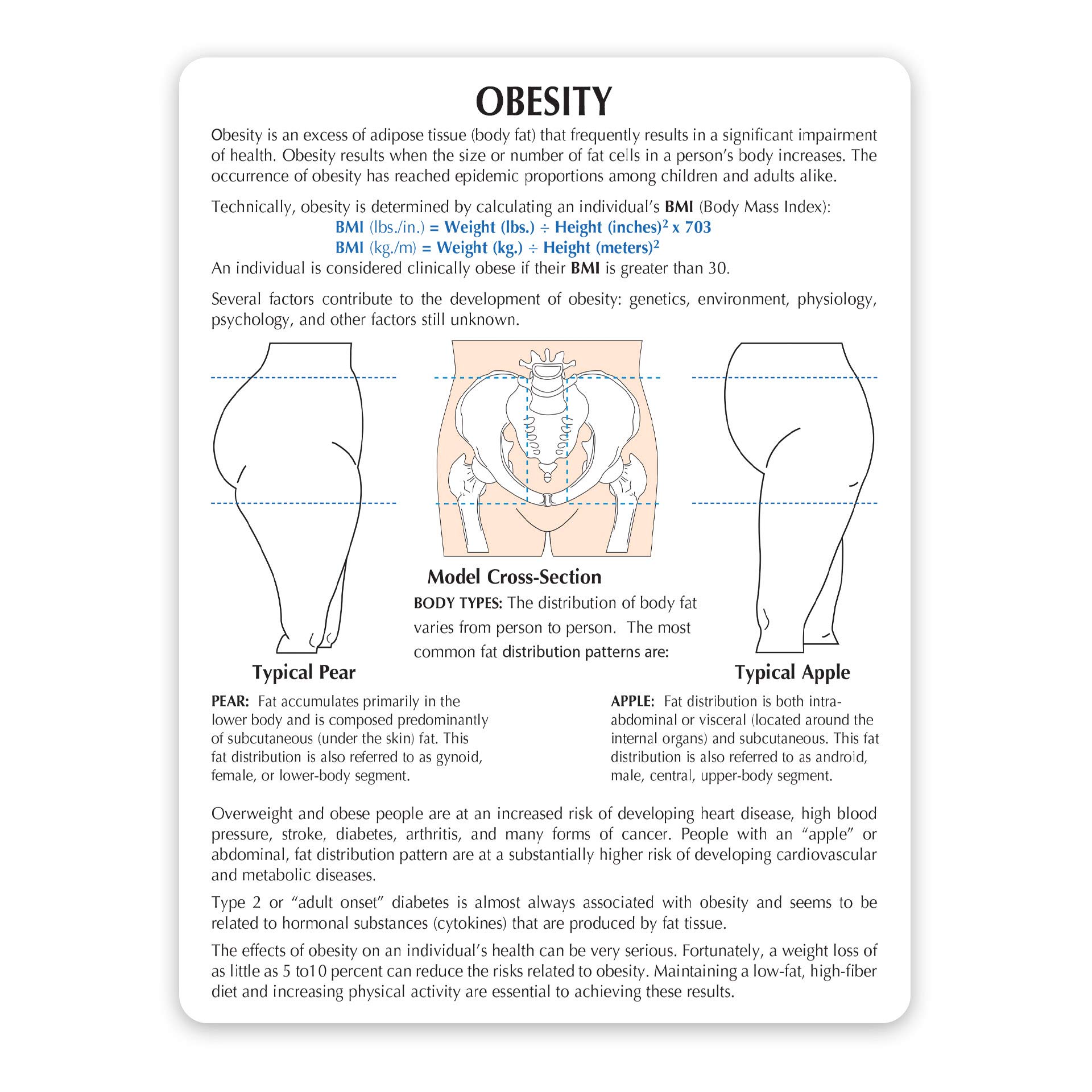 Obesity Model | Human Body Anatomy Replica of Overweight Body Types for Doctors Office Educational Tool | GPI Anatomicals
