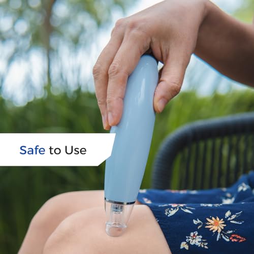 Bug Bite Remover Get Itch Relief from Mosquito Bites with This Suction Tool. This is Similar to The Bug bite Thing seen on Shark Tank, Except Ours is Better with a Battery Powered Suction Pump.