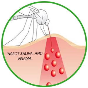 Bug Bite Remover Get Itch Relief from Mosquito Bites with This Suction Tool. This is Similar to The Bug bite Thing seen on Shark Tank, Except Ours is Better with a Battery Powered Suction Pump.