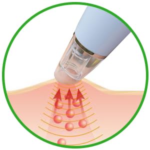 Bug Bite Remover Get Itch Relief from Mosquito Bites with This Suction Tool. This is Similar to The Bug bite Thing seen on Shark Tank, Except Ours is Better with a Battery Powered Suction Pump.