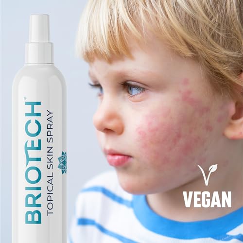 BRIOTECH Topical Skin Spray, Hypochlorous Acid Spray for Body & Face, Eyelid Cleanser, HOCl Facial Mist, Support Against Irritation, Calm Redness, Soothe Scalp, Packaging May Vary, 4 oz ea, 2 ct