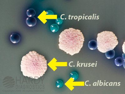 HardyCHROM Candida, Chromogenic Medium for C. Tropicalis, Krusei, and Albicans; 15x100mm Plate, Order by The Package of 10, by Hardy Diagnostics