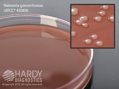 Chocolate Agar, (GC Agar Base with 1 Percent Bovine Hemoglobin and Koenzyme Supplements), for Fastidious Bacteria, 15x100mm Plate, Order by The Package of 10 Plates, by Hardy Diagnostics