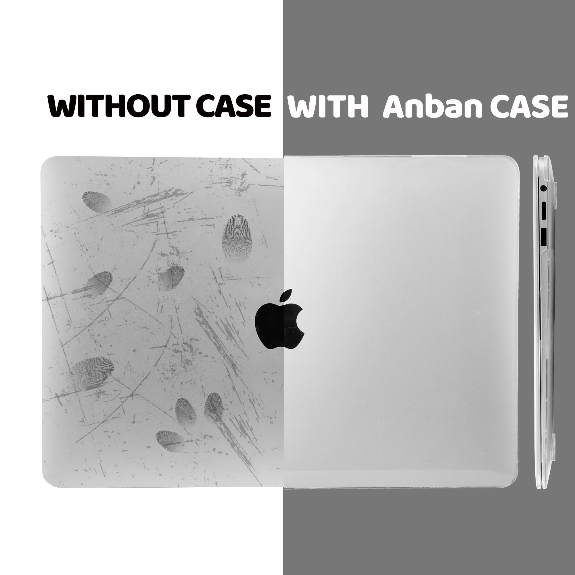 Anban Compatible with MacBook Pro 13 inch Case M2 2022, 2021 2020 2019 2018 2017 M1 A2338 A2251 A2289 A2159 A1989 A1708 A1706 Touch Bar, Clear Plastic Hard Shell Case +Keyboard Cover +Screen Protector