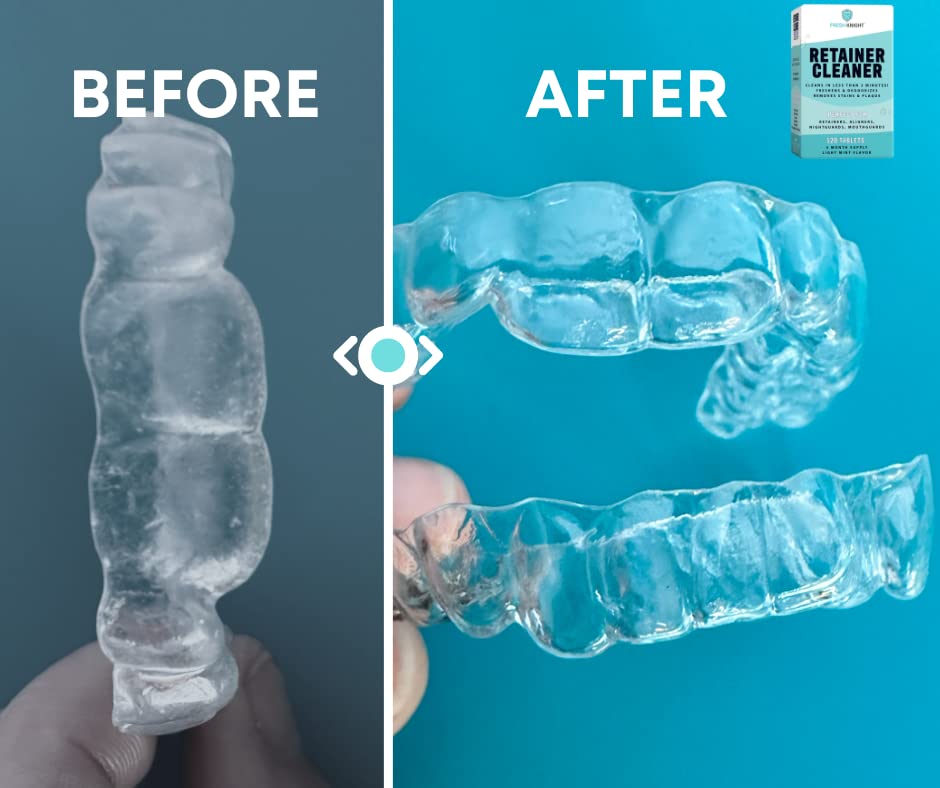 Retainer Cleaner, Denture Cleaner (120 Tablets) Removes Cloudiness, Brightens and Freshens Clear Aligners, Retainers, Night Guards, Mouth Guards, Dental Appliances, Fresh Knight