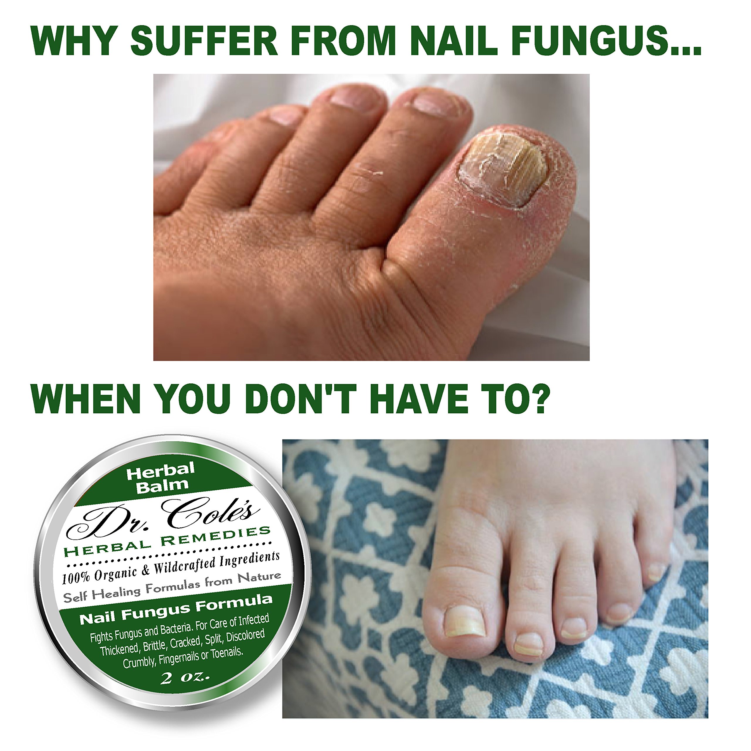 Dr. Cole’s Organic Herbal Nail Fungus Balm - May Assist with Repairing Thick, Cracked or Flakey Fingernails and Toenails