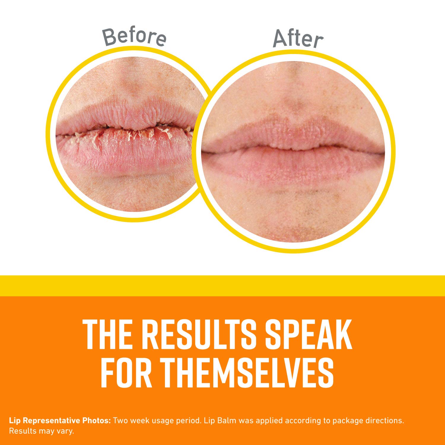 O'Keeffe's Lip Repair SPF 35 Lip Balm Stick, (Pack of 1)