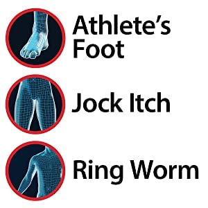 Globe Miconazole Nitrate 2% Antifungal Cream 1 oz, Cures Most Athletes Foot, Jock Itch, Ringworm and More. Compare to the Leading Name Brand
