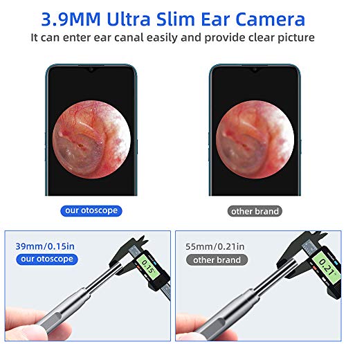 Cainda Otoscope USB Ear Camera, Ear Wax Removal Endoscope with Light for Android Phone Window and Mac PC (Not for iPhone), Digital USB Camera with Ear Cleaning Earwax Removal Tool