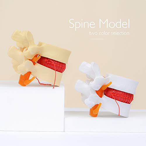 Anatomical Herniated Lumbar Vertebrae Disc Prolapse Model Human Medical Anatomy