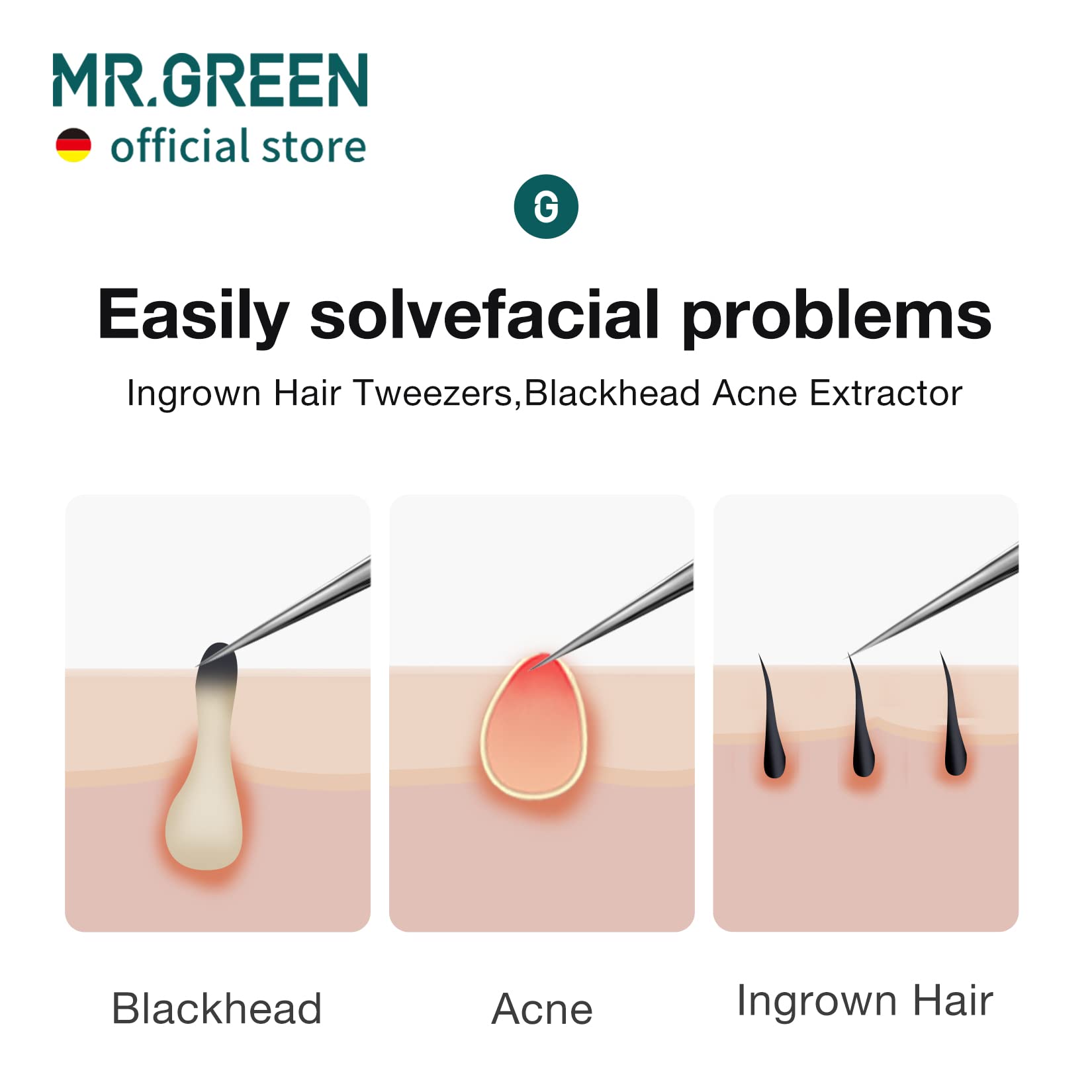 MR.GREEN Ingrown Hair Tweezers Needle Nose Pointed Tips Tweezers For Eyebrows Splinters Blackhead Removal Acne Clip Extractor (Long)
