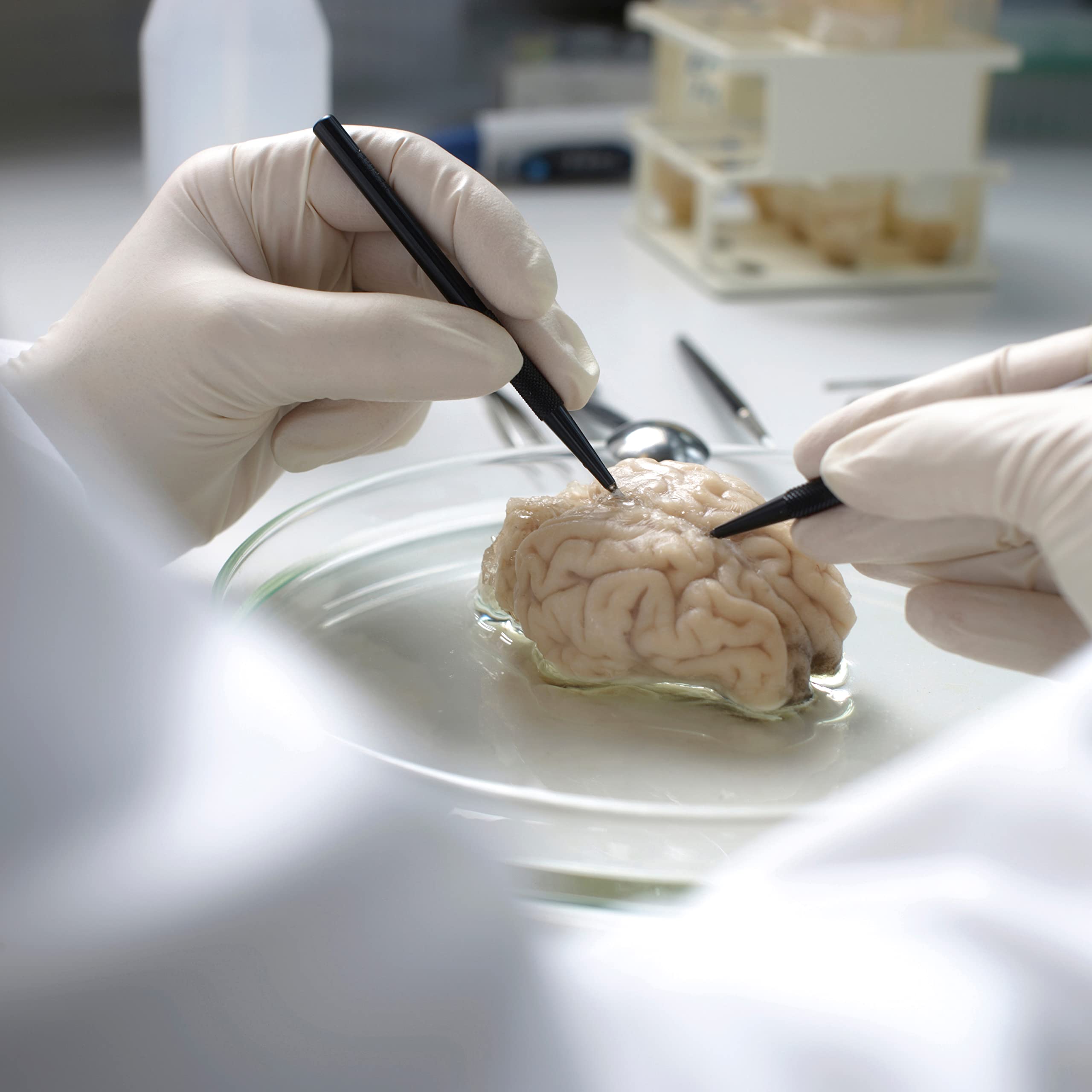 Anatomy Lab Preserved Sheep Brain Specimen for Dissection, without Hypohysis, Vacuum Pack of 10
