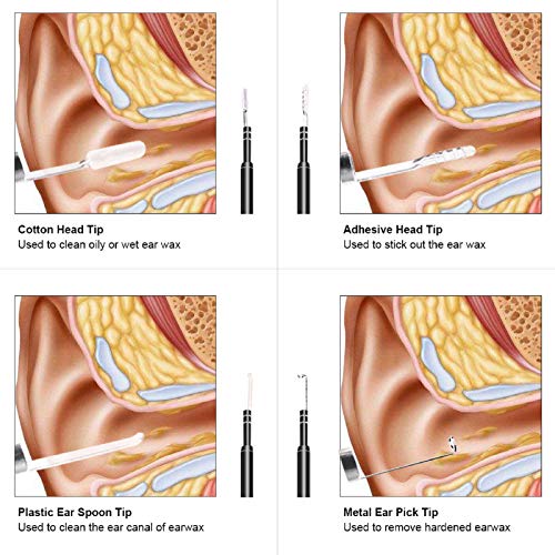 iFCOW Earwax Removal Endoscope, Ear Wax Cleaning Tool with Clear Visual Camera