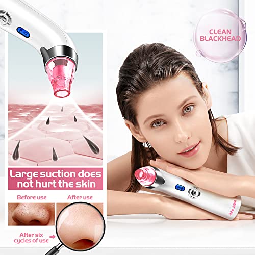 Blackhead remover pore vacuum, Facial Pore Cleaner, Electric Acne Comedone Whitehead Extractor Tool with 5 suction power, 4 probes, Blackhead Remover Suction for Women & Men (Pink)