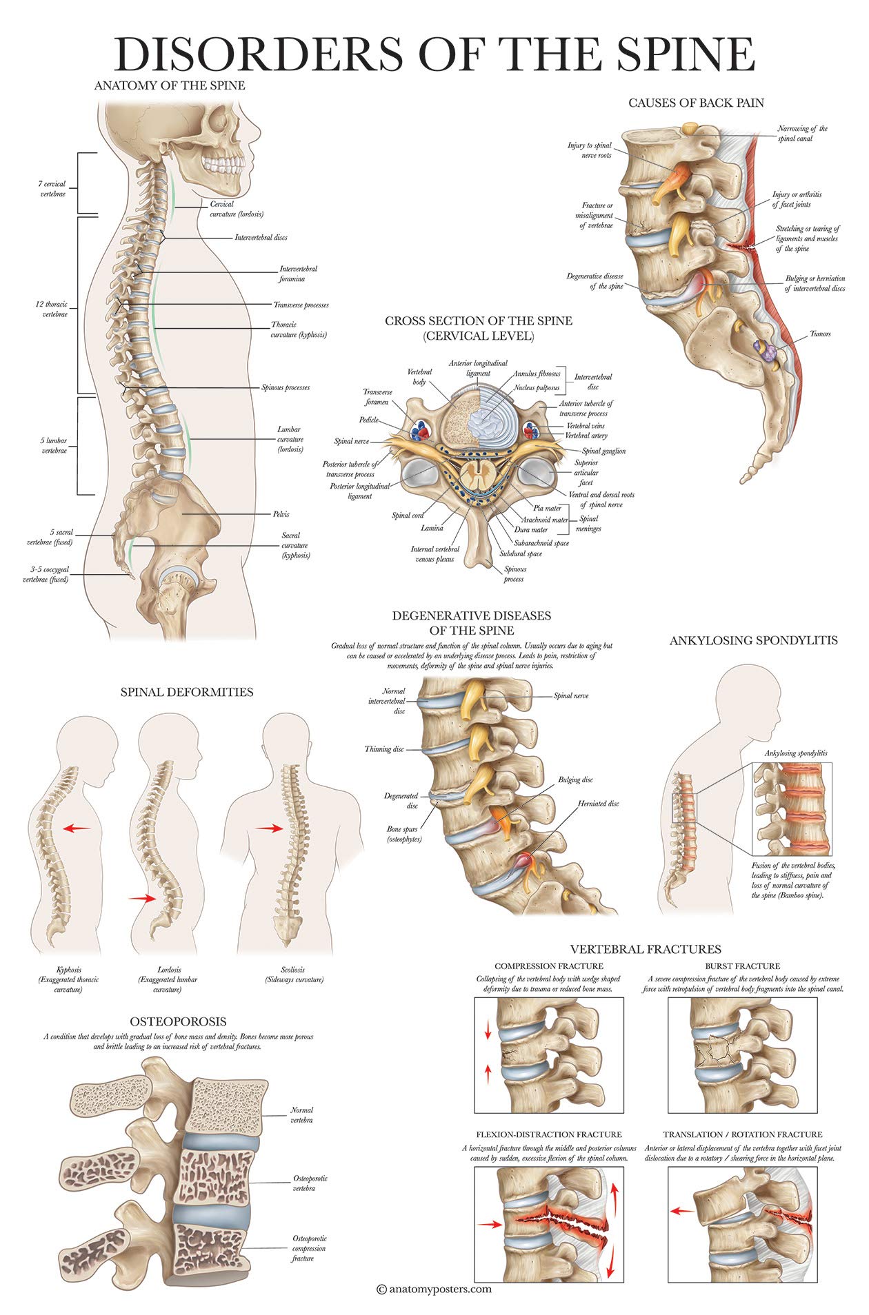 Palace Learning 4 Pack - Anatomical Poster Set - Laminated - Muscular, Skeletal, Dermatomes, Disorders of the Spine - Anatomy Chart Set (LAMINATED, 18” x 24”)