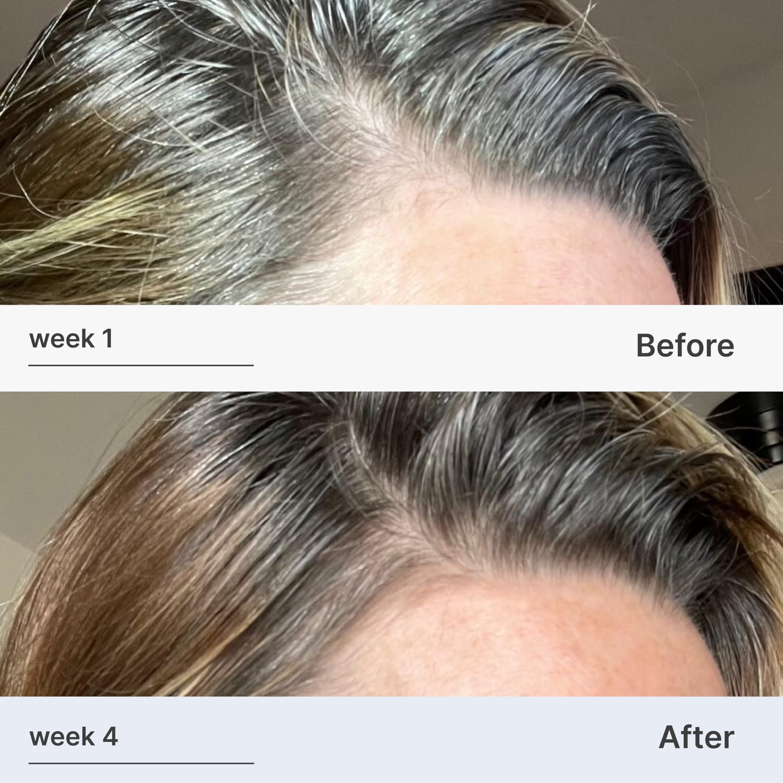 Better Not Younger Superpower Hair & Scalp Duo Set - Fortifying 2fl.oz. plus Liquid Comb - Leave-in Serum w/ Massaging Applicator for Stronger, Thicker, Fuller