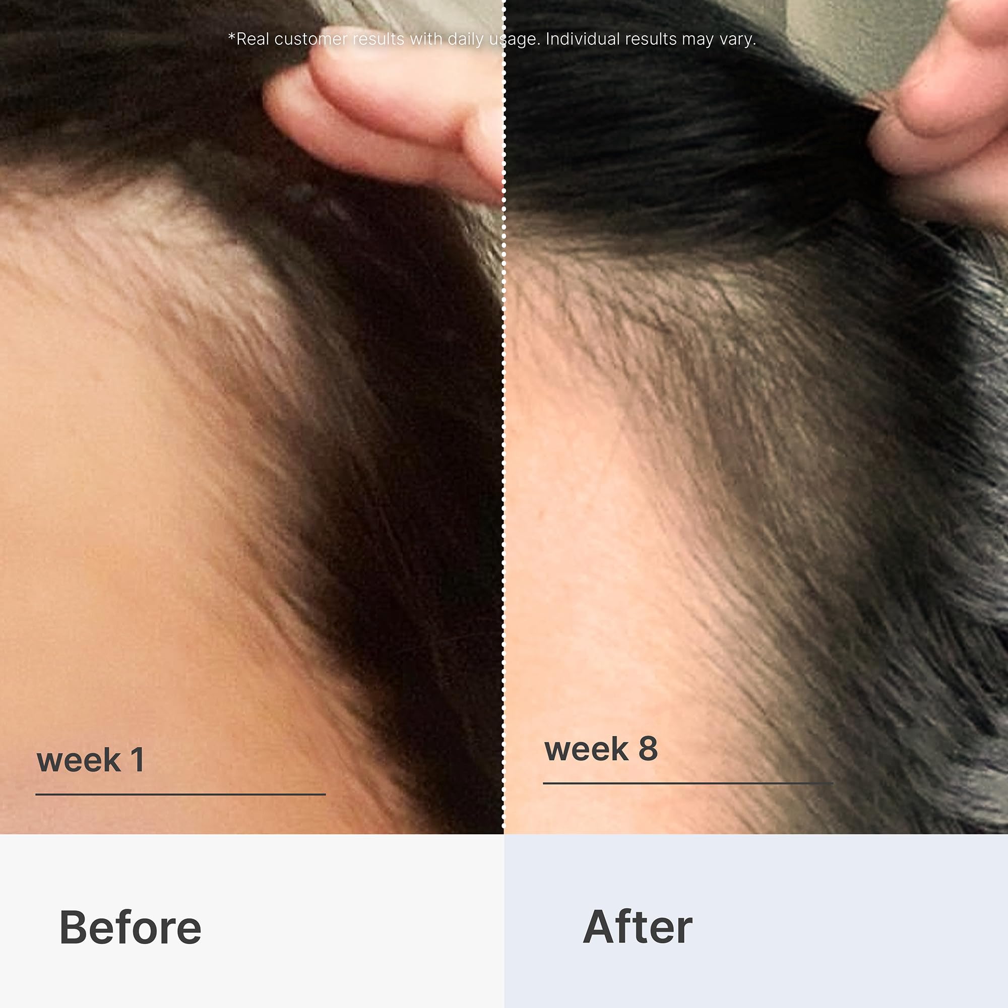 Better Not Younger Superpower Hair & Scalp Duo Set - Fortifying 2fl.oz. plus Liquid Comb - Leave-in Serum w/ Massaging Applicator for Stronger, Thicker, Fuller