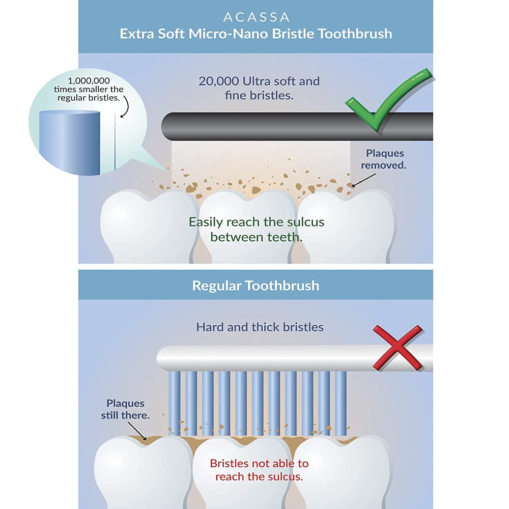 ACASSA, Super Soft Toothbrush, Nano Toothbrush, Micro Toothbrush, 20000 Bristle, Gum Toothbrush, Toothbrush in Case, Sensitive Toothbrushes, Nano Toothbrushes for Adults and Kids, Slim, Black, White
