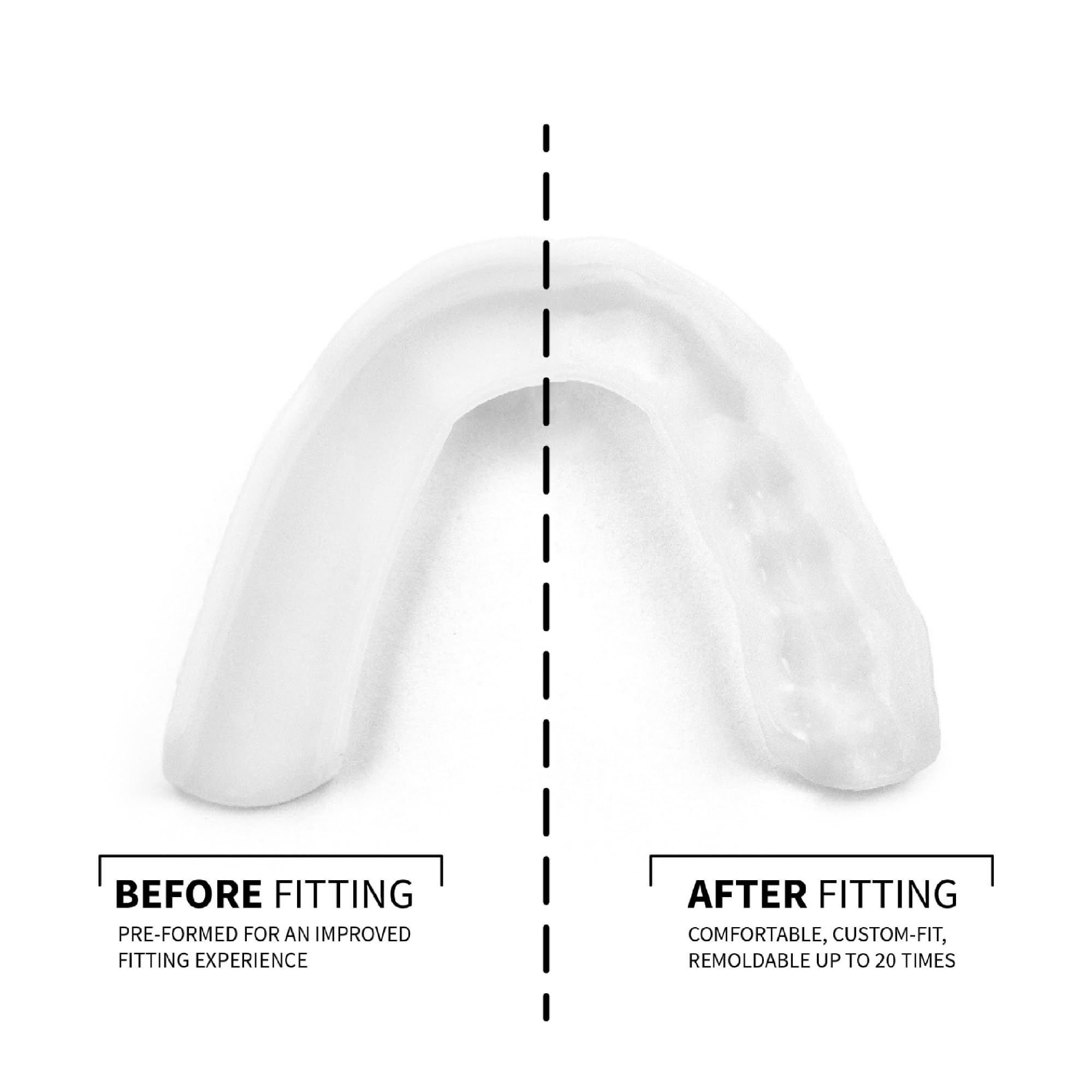 SOVA 3D Night Guard - 2.0mm Thin - Custom-Molded Fit - Protects Against Nighttime Teeth Grinding & Clenching - FSA/HSA Eligible - Odor & Taste Free - Remoldable Up to 20 Times - Non Toxic