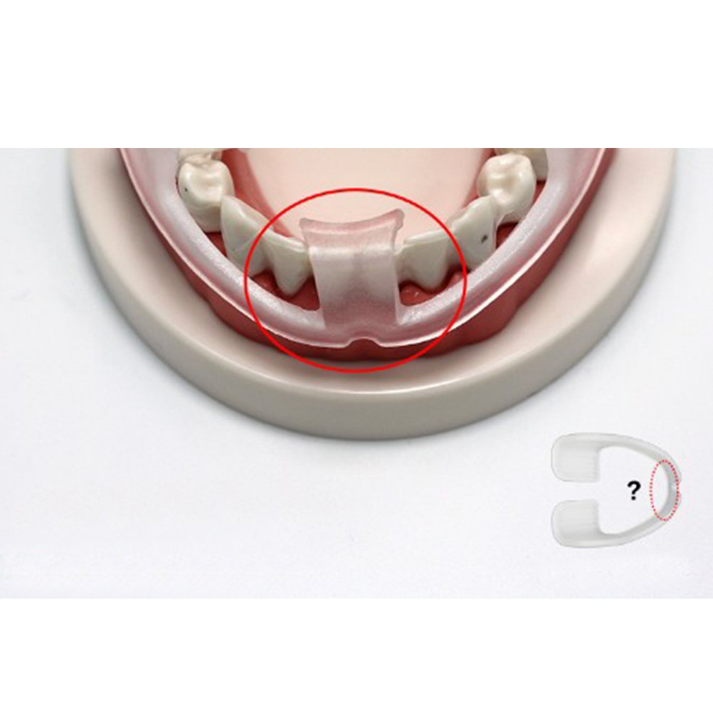 BESPORTBLE 3Pcs Dental Night Protector Dental No More Teeth Grinding Food Grade EVA Supplies for Kids (Transparent)