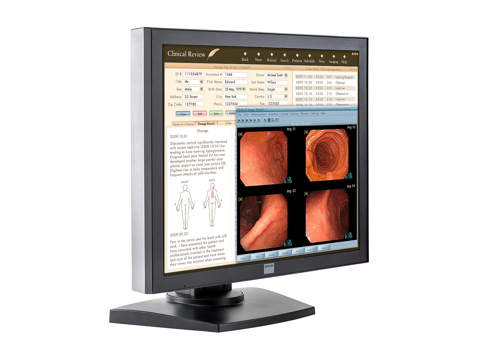 Monitors Barco MDRC-1119 1MP 19" Color Clinical Review Display (K9301800A)