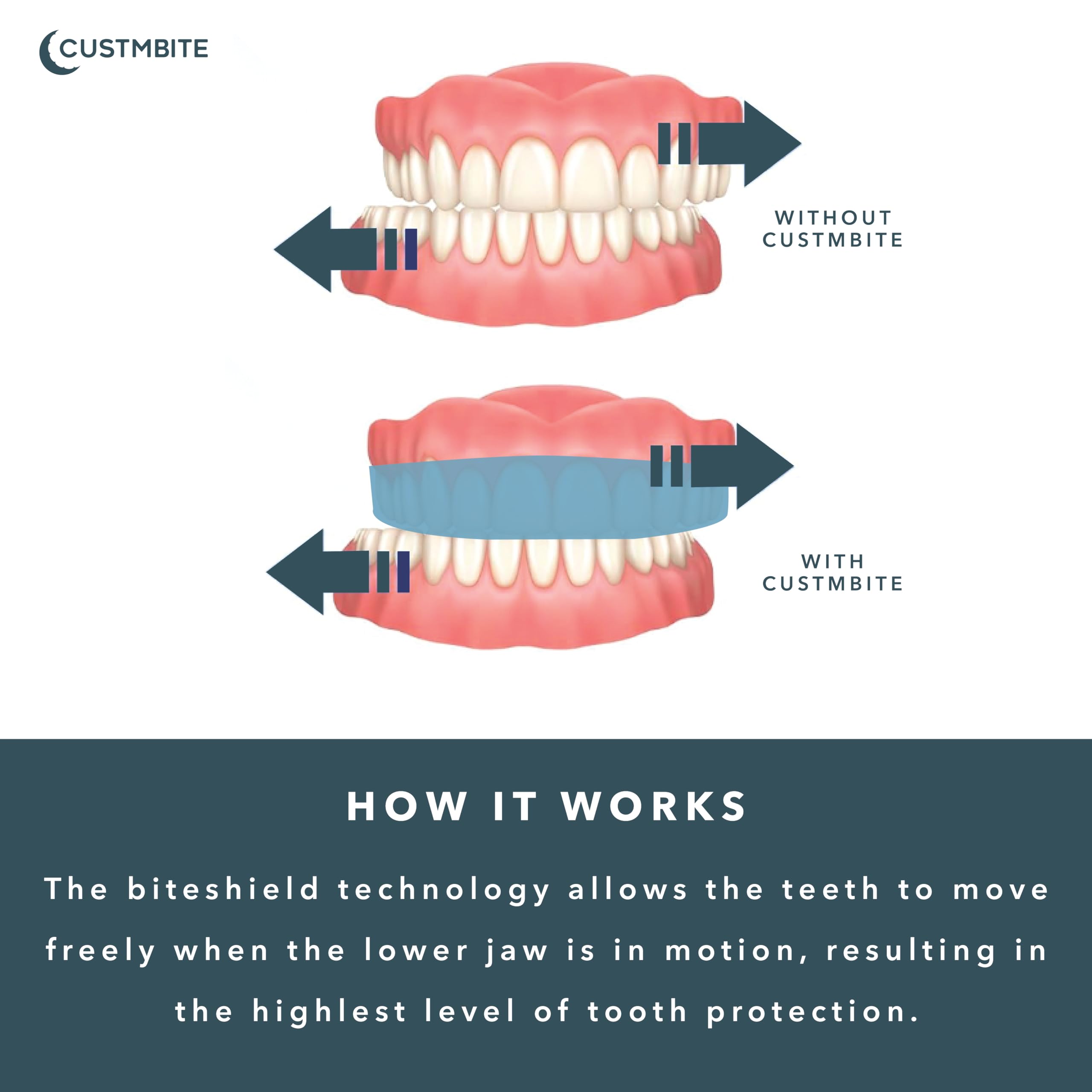 CUSTMBITE Premium Hard Surface Night Guards for Teeth Grinding, 2 Pack with Mouth Guard Case, USA Made, Mouth Guard for Clenching Teeth at Night, Bruxism NightGuard - Customizable Fit Dental Guard
