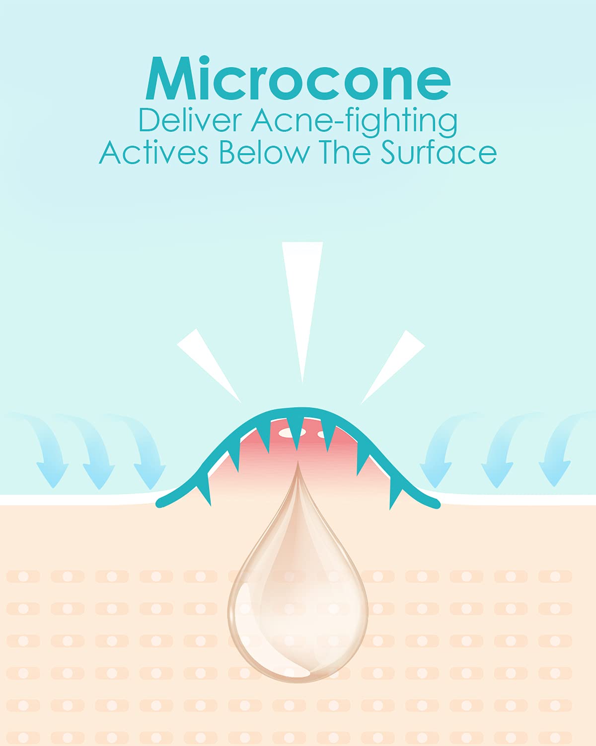 +1HEROLABS Microdart Acne Patch (18 Patches) - Hyaluronate, Salicylic Acid, Vitamin C, Microdart Pimple Patch for Deep, Early Stage and Hidden Pimples (18 Count (Pack of 1))