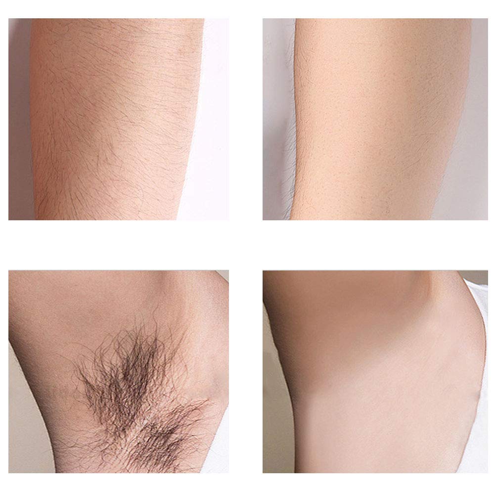 100Pcs Non-Woven Wax Strips Facial and Body Hair Removal Waxing Strips Epilating Bikini Wax Strip Paper