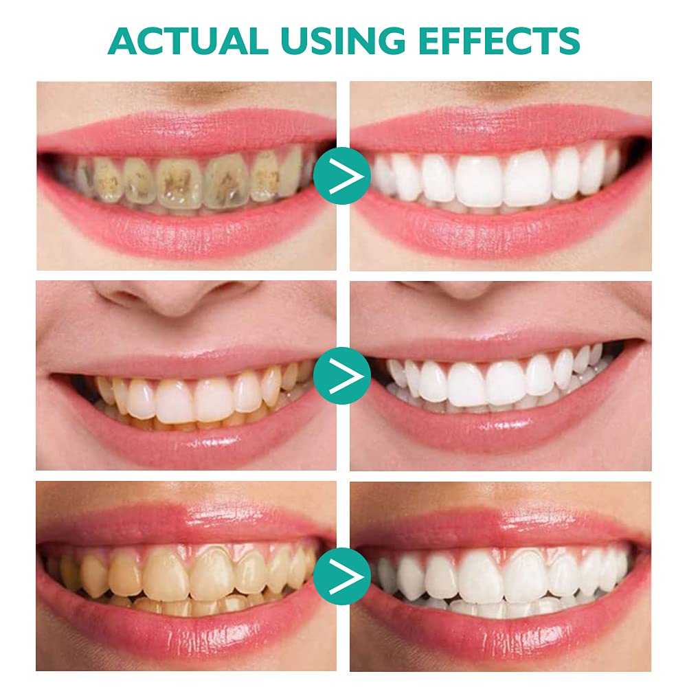 2 Pcs Foam Toothpaste, Ultra-fine Mousse Foam Deeply Cleaning Gums, Whitens Teeth & Deeply Gums Care & Easy to Use, 360ºCare for Oral Health, 60ml*2 (Mint, 2pcs)