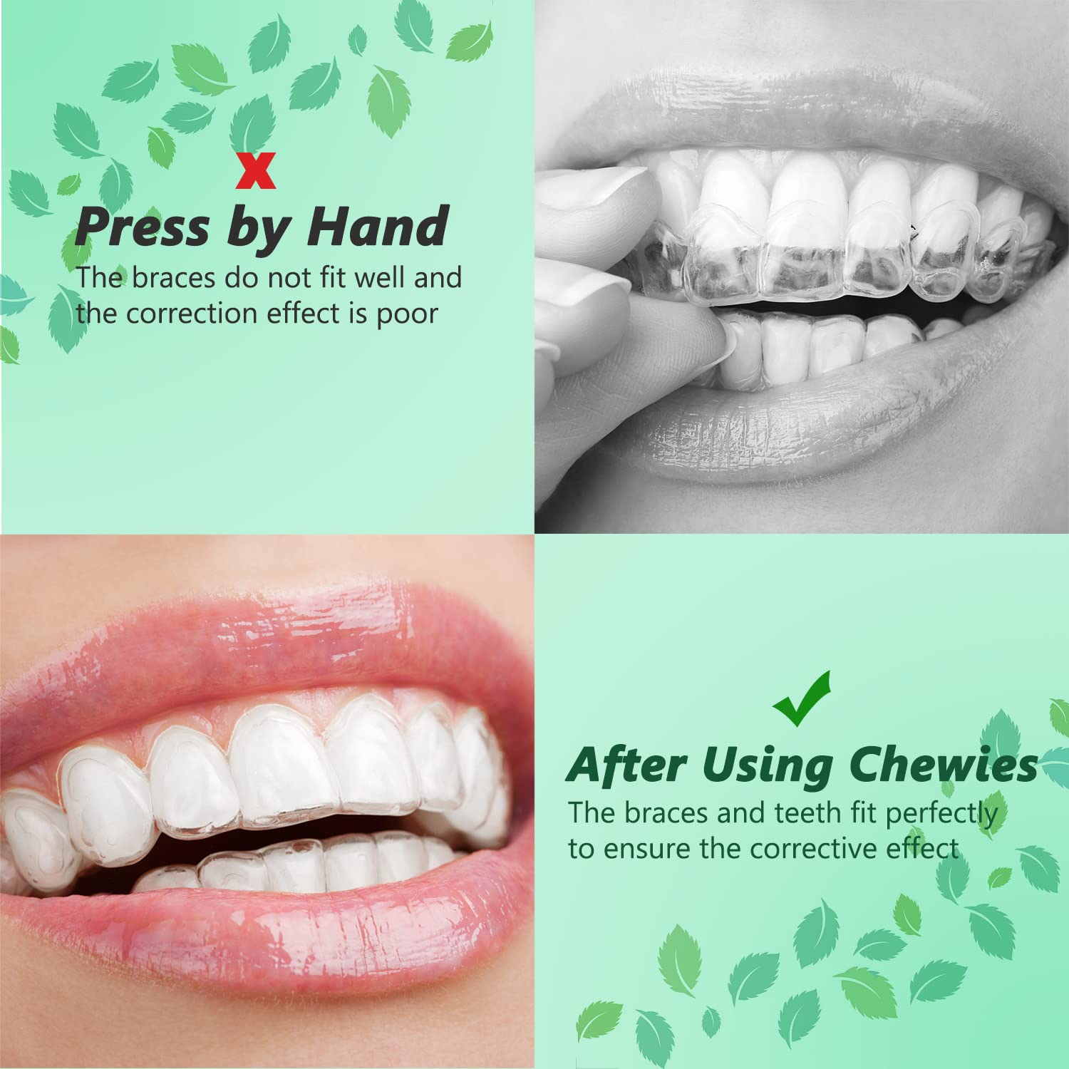 10 Pieces Aligner Chewies, Aligner Tray Seaters Chewies Orthodontic Dental Chewies for Aligner Chompers, Green